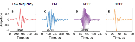 All About Echolocation