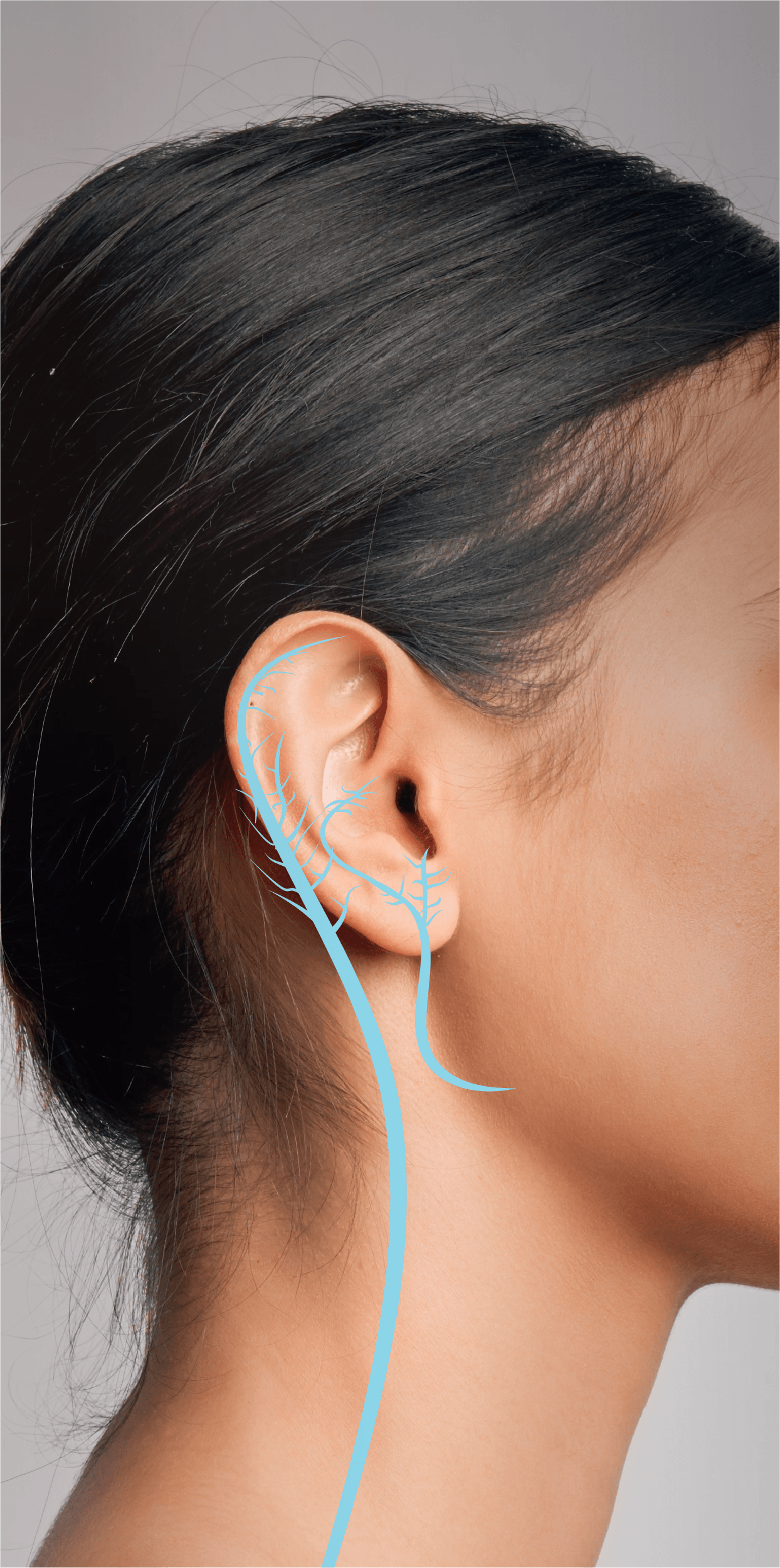 Vagus Nerve Stimulation Genetic Optimization