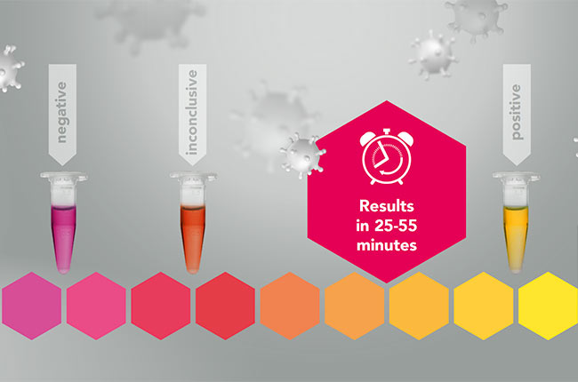 Nový LAMP-test prináša presnosť PCR-testov • MultiplexDX