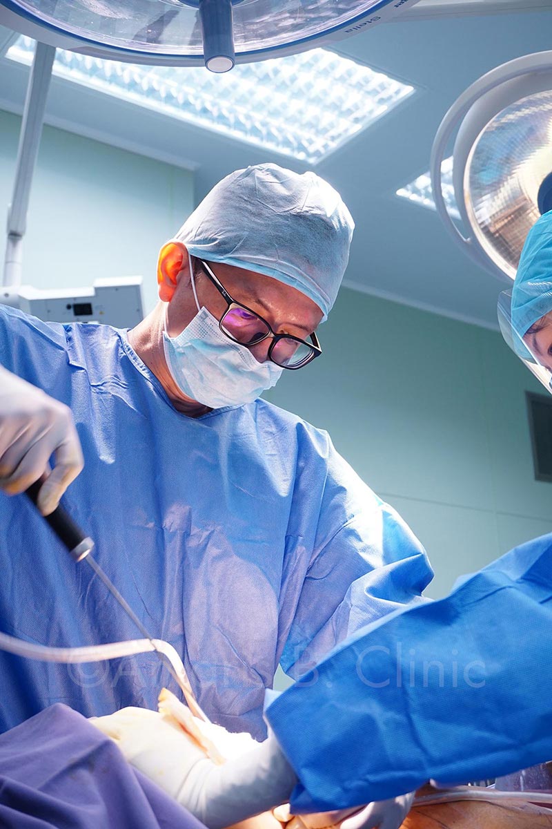 Fat grafting for the hands, face, breasts, and buttocks