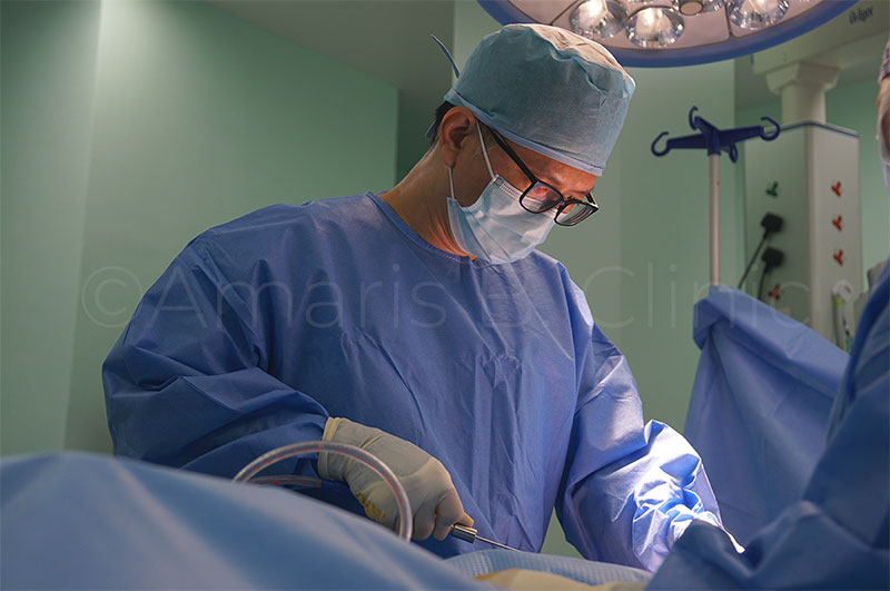 Is skin dimpling after liposuction normal?