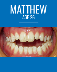 Orthodontist in Winnipeg, MB | Rykiss Orthodontics