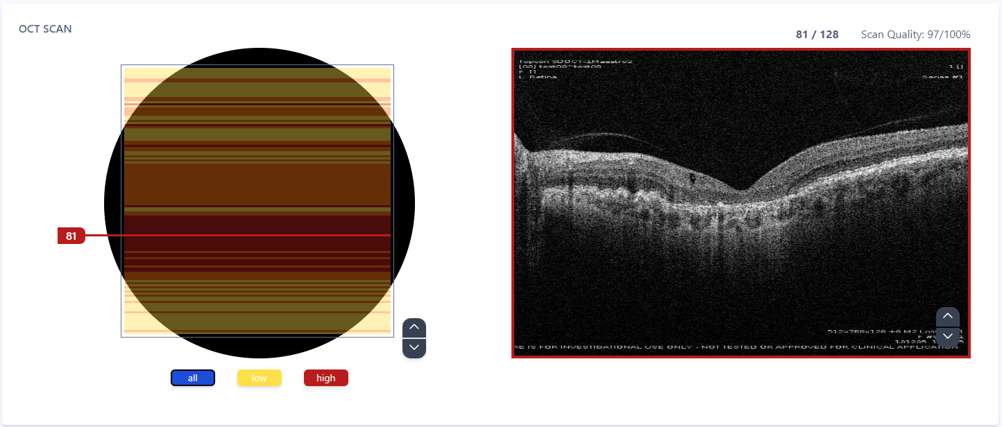 RetinaLyze - Efficient, safe and fast eye screenings