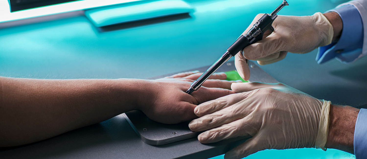 Do You Need a Surgical Implant to Operate Your Smart Home?