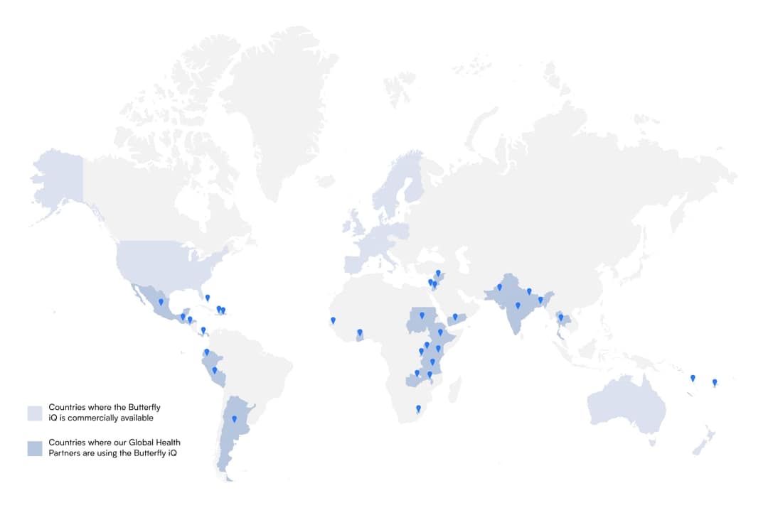 Our Mission - Butterfly Network
