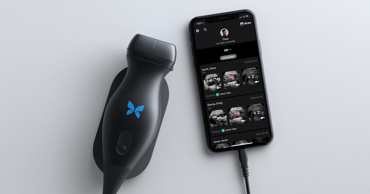 Free handheld POCUS demonstration with the Butterfly iQ+