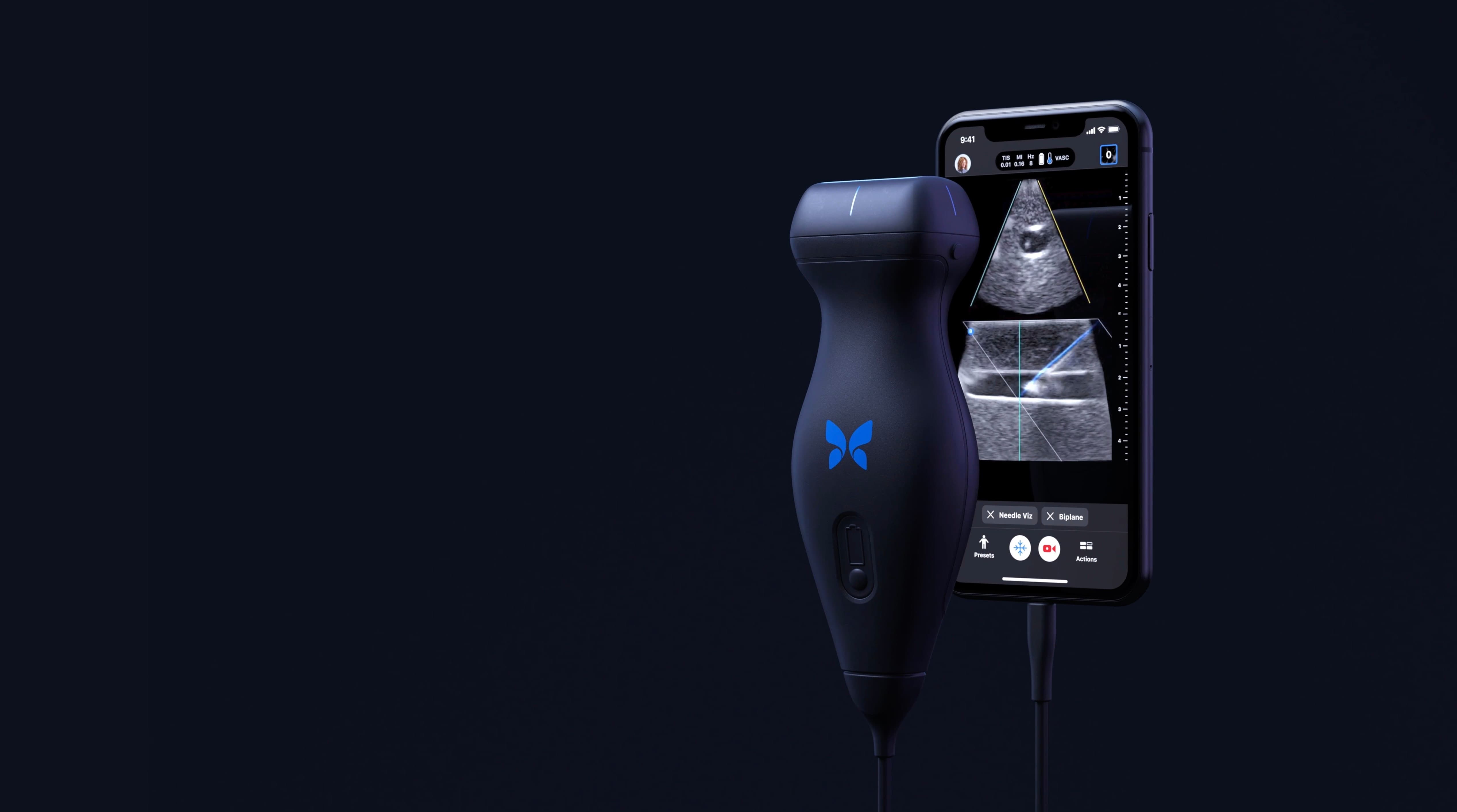 One probe, whole-body imaging | Butterfly iQ+