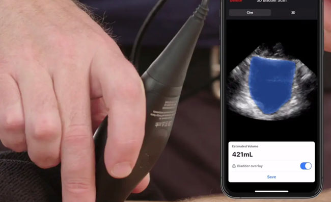 Point of care ultrasound for Primary Care | Butterfly iQ3