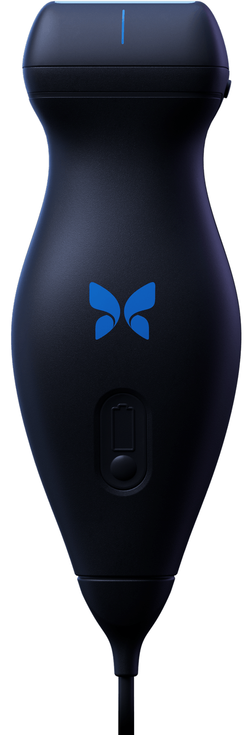 Handheld portable ultrasound machine, advanced POCUS solutions