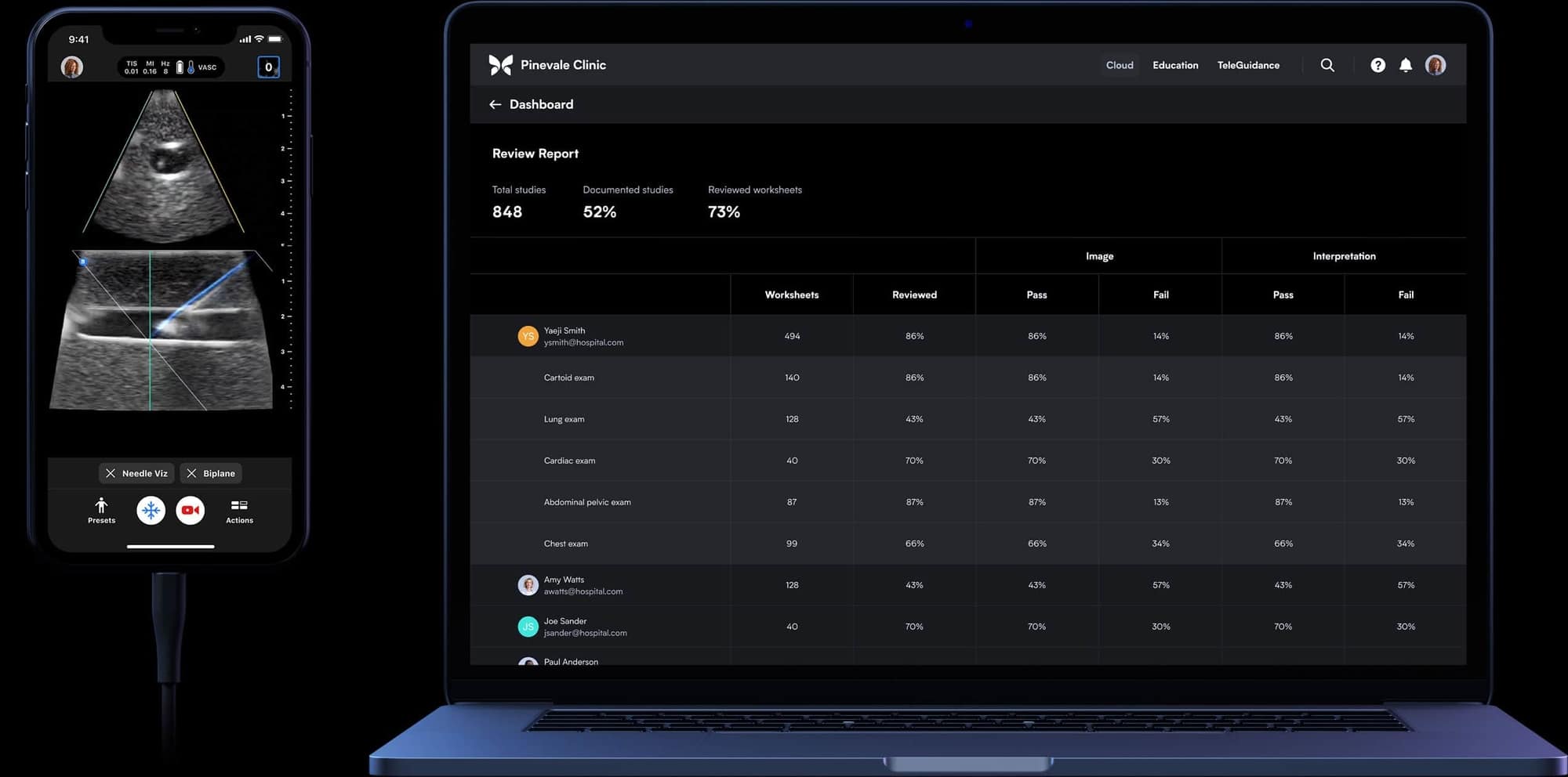 Handheld portable ultrasound machine, advanced POCUS solutions