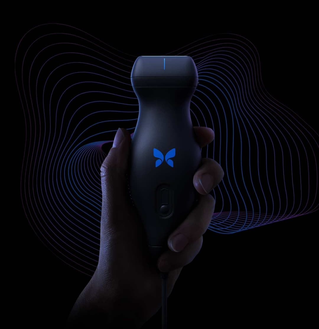 Butterfly iQ+ handheld ultrasound for urgent emergency cases