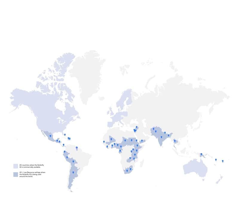 Our Mission - Butterfly Network