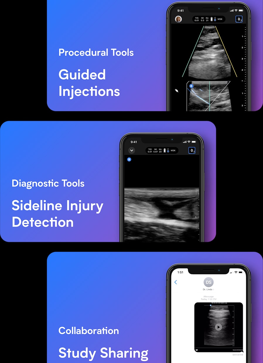 Portable, handheld orthopedic ultrasound machine for guided interventions
