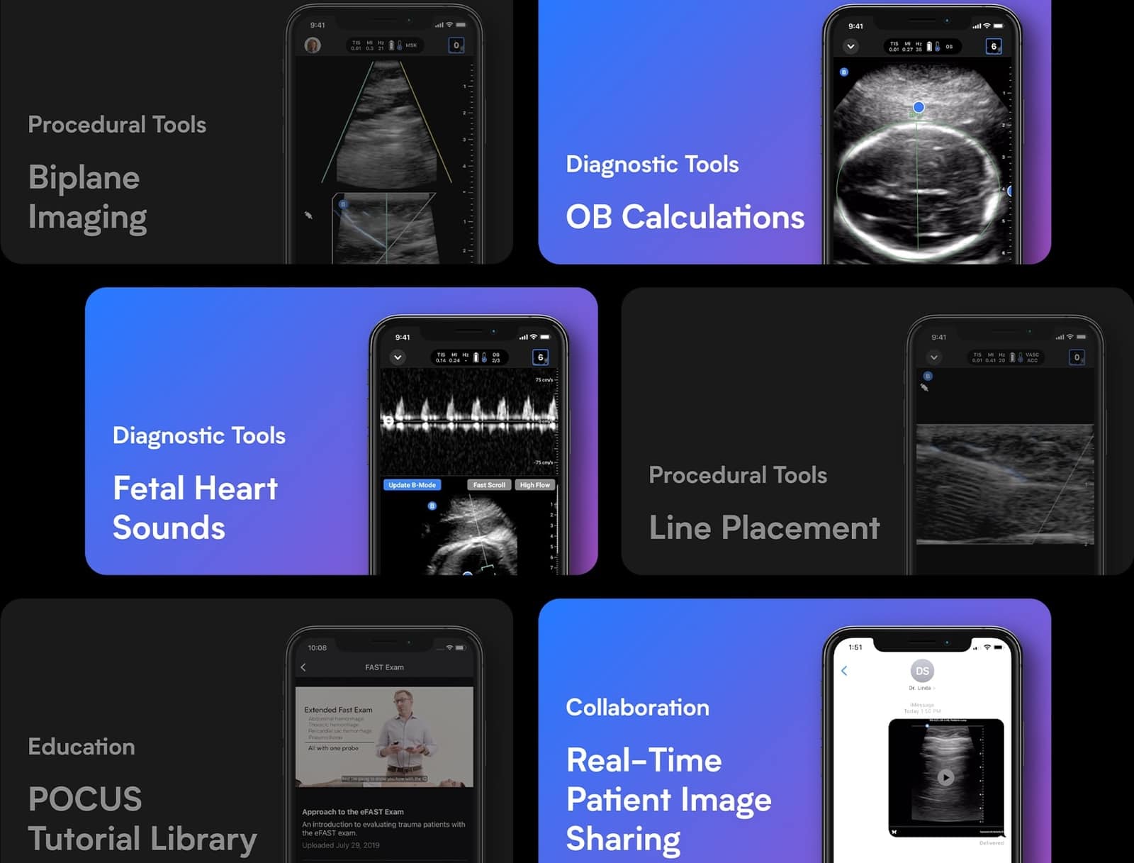 Handheld point-of-care ultrasound for OB/GYN | Butterfly iQ+