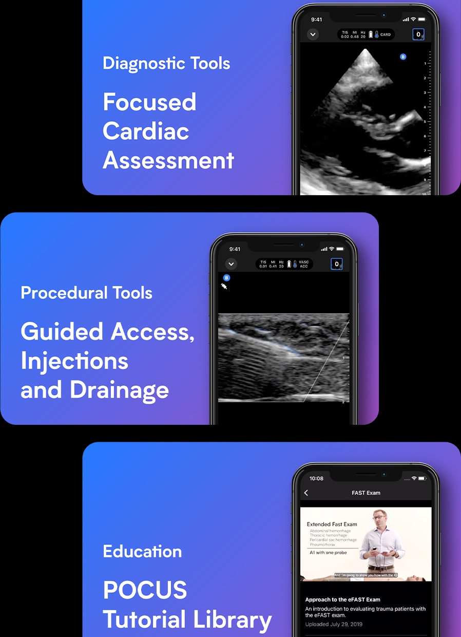 Point-of-care, handheld portable ultrasound for Hospitalists