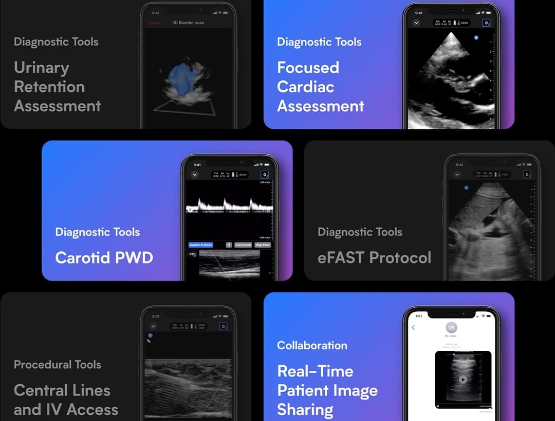 Handheld, portable ultrasound for Cardiology | Butterfly iQ+
