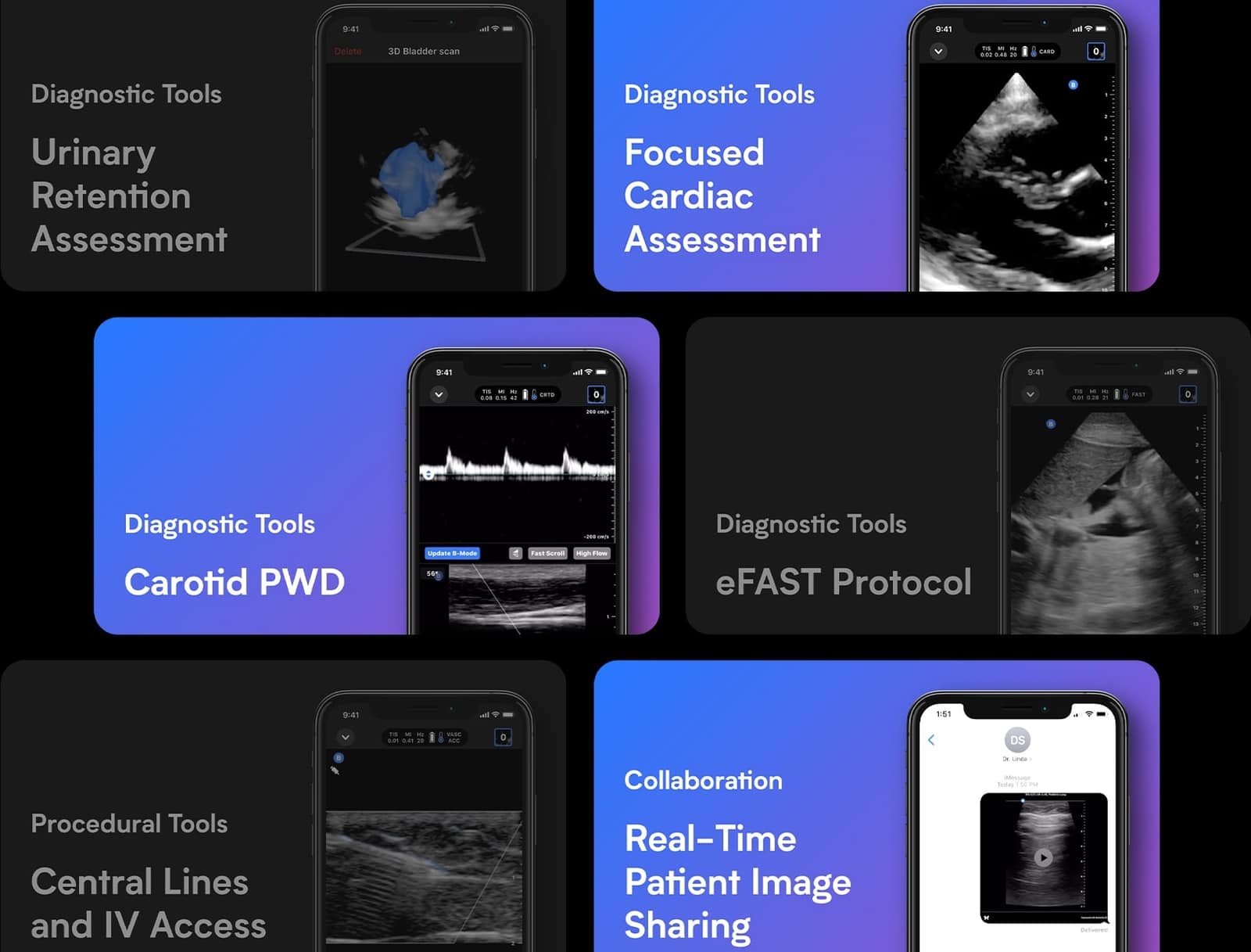 Handheld, portable ultrasound for Cardiology | Butterfly iQ+