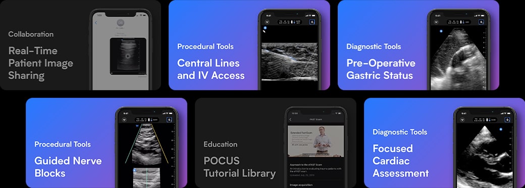 Handheld, portable ultrasound machine for guided anesthesia