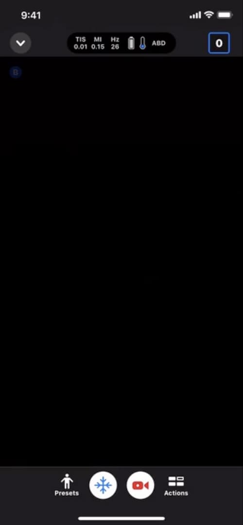 Butterfly for Education: ultrasound for the future of care