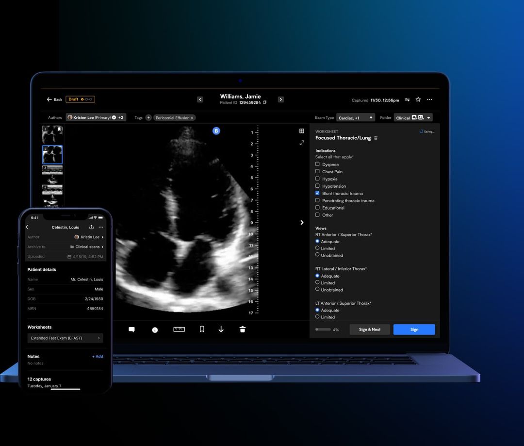 Butterfly for Education: ultrasound for the future of care