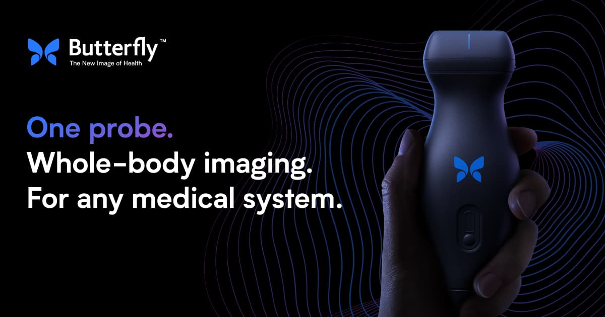 Why Choose Butterfly