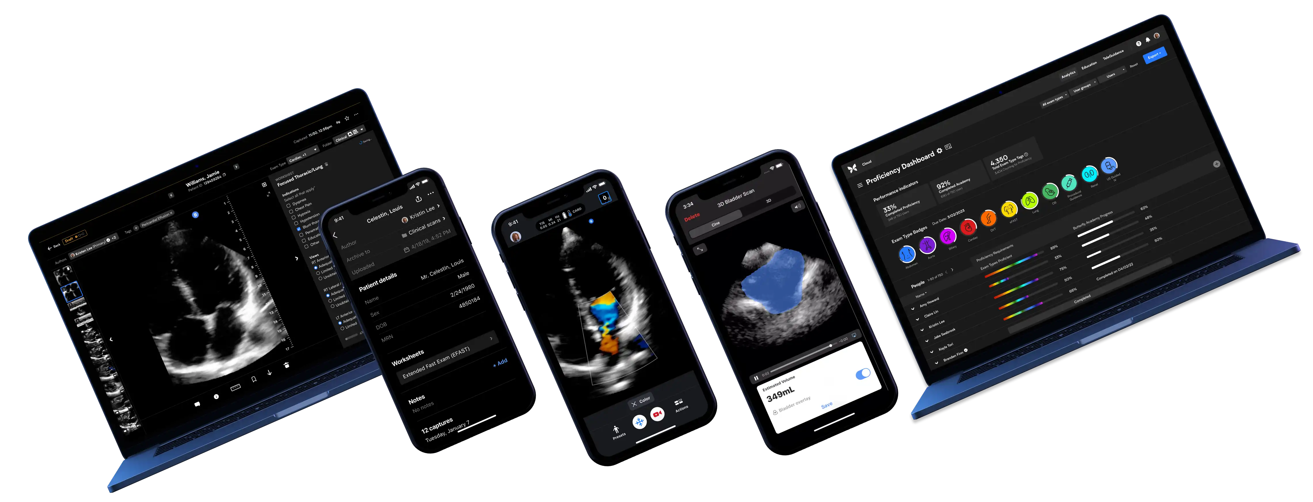 Compass™ Software | Your Ultrasound Workflow Solution
