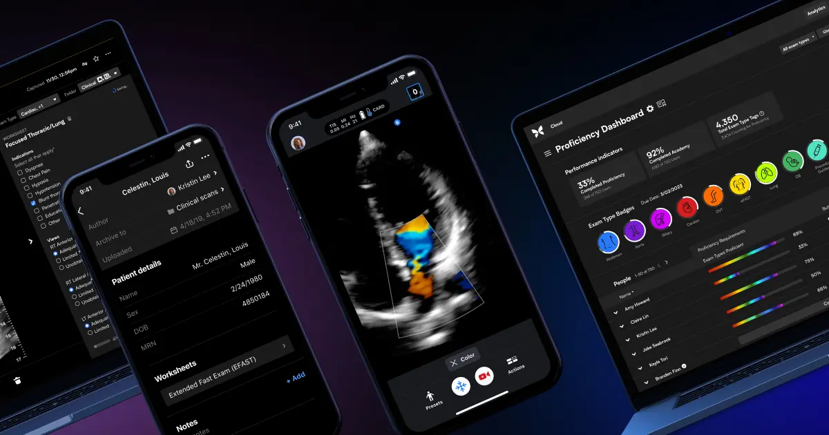 Compass™ Software | Your Ultrasound Workflow Solution