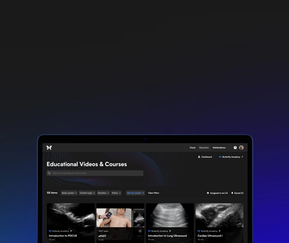 The clear answer in point-of-care ultrasound | Butterfly iQ3