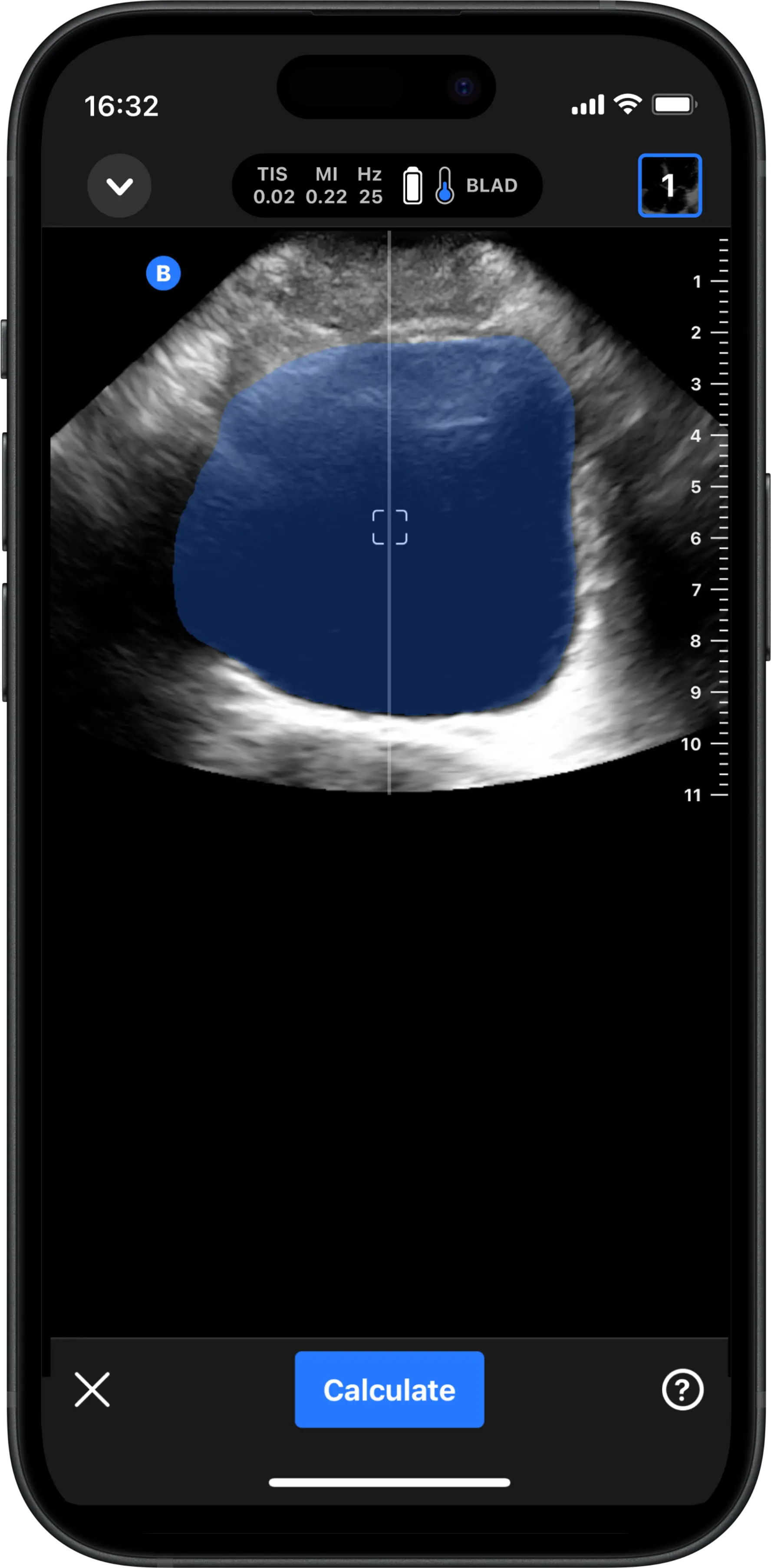 iQ3 Ultrasound | The clear answer in point-of-care ultrasound.