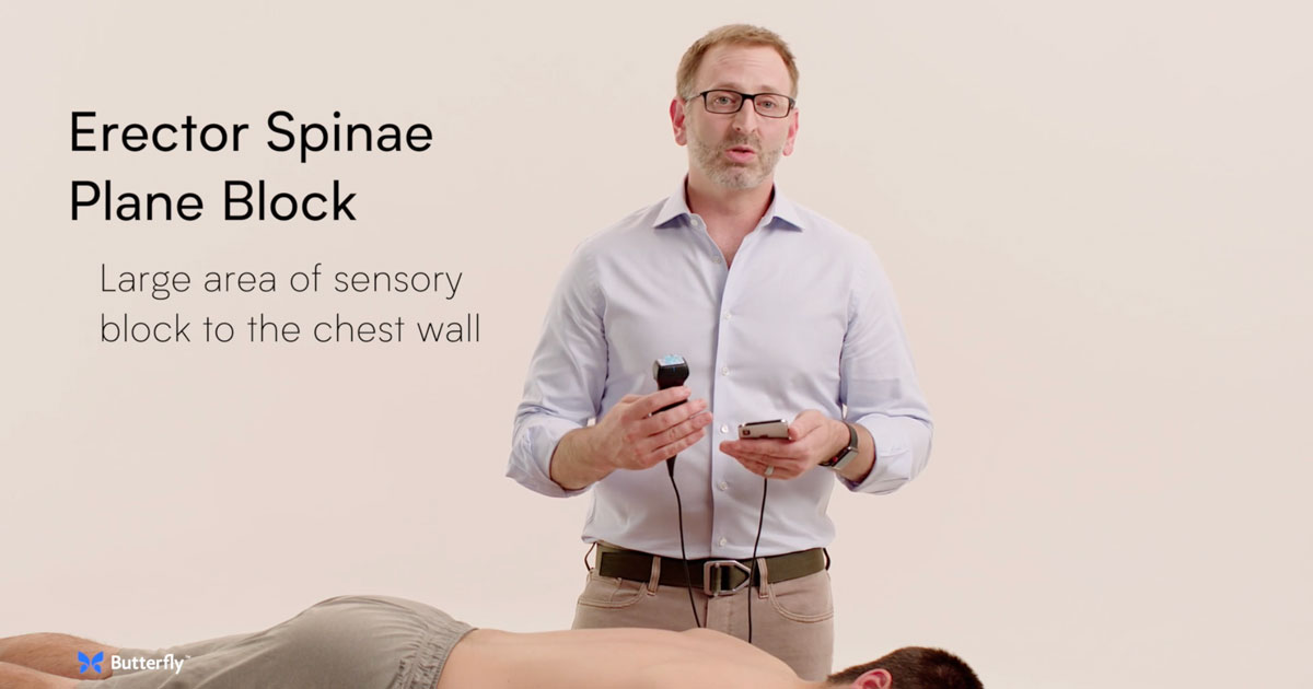 Performing Erector Spinae Plane Nerve Block – Butterfly iQ