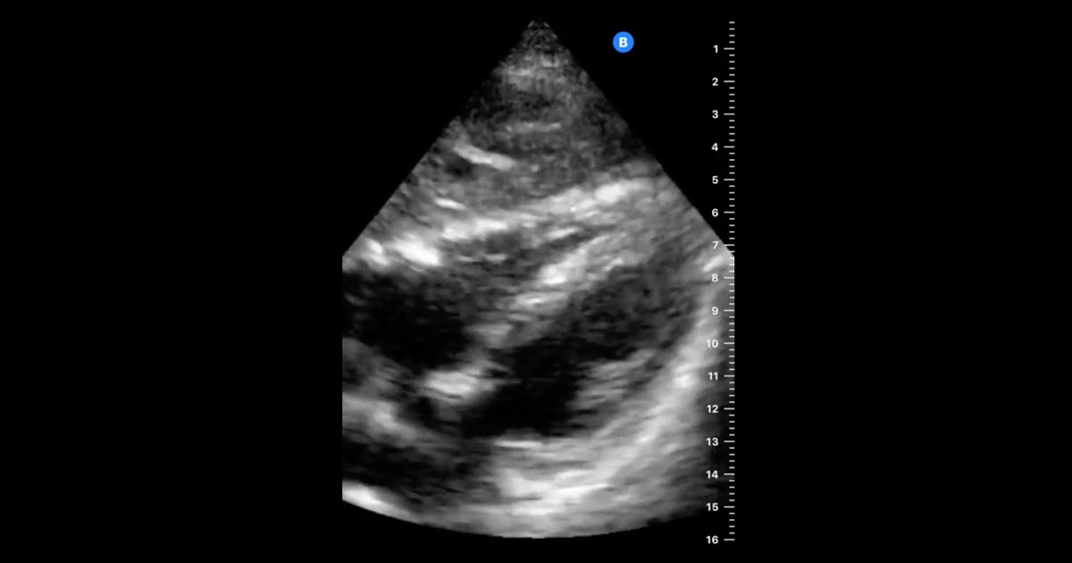 Case Studies - The Power to Reveal Signs of Life