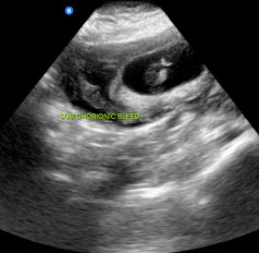 Interested in POCUS clinical images for Emergency Medicine?