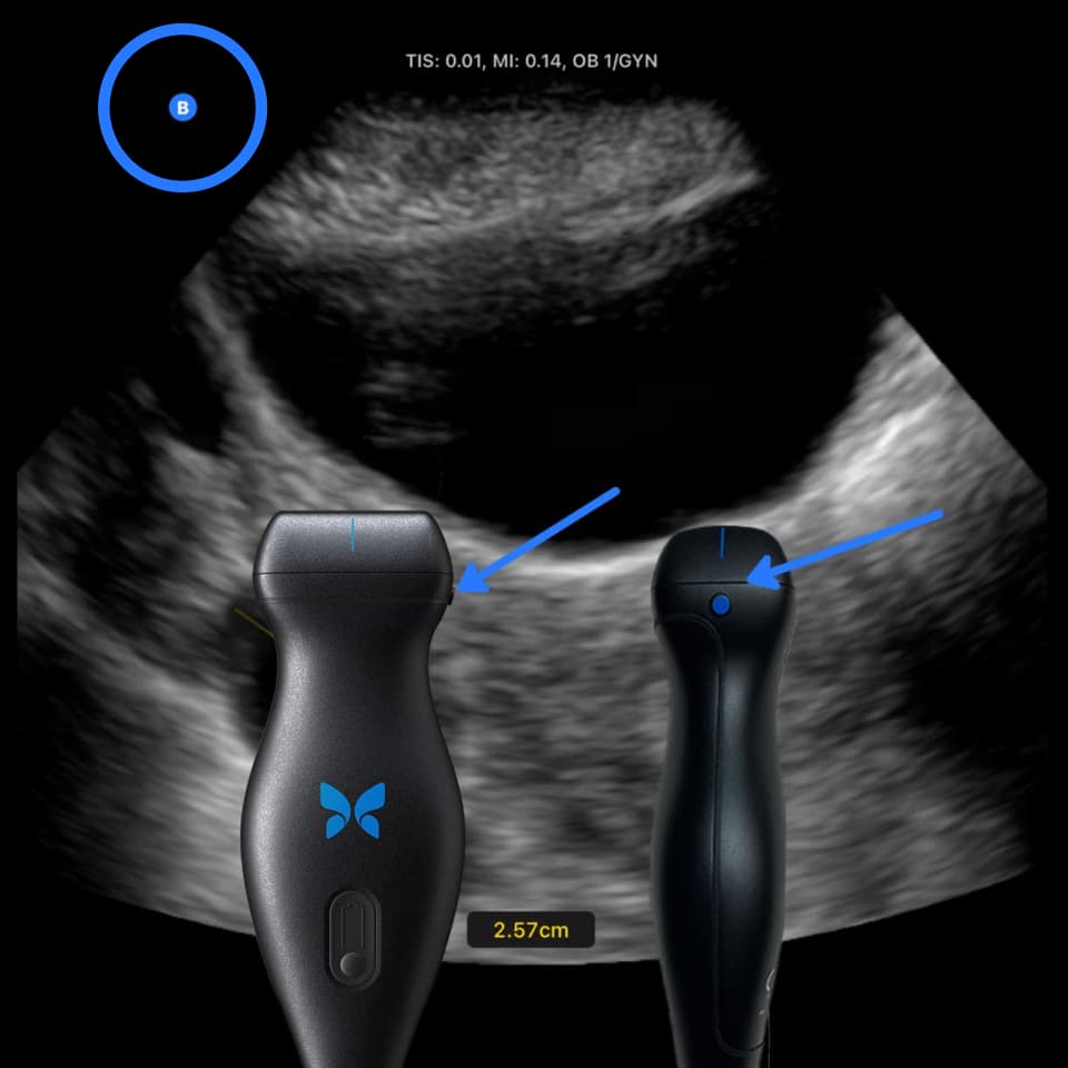 Learn the basics of probe maneuvering and image optimization
