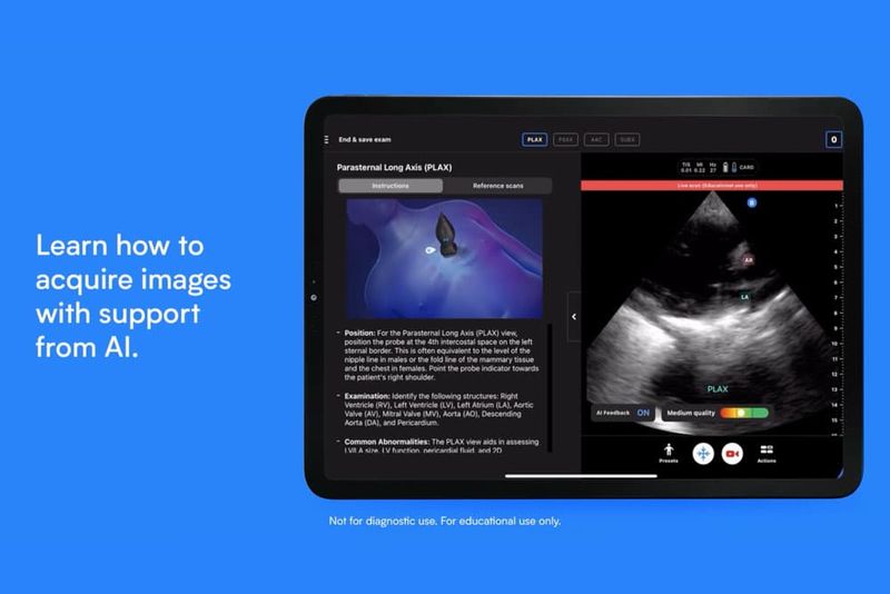 Press - Butterfly Network