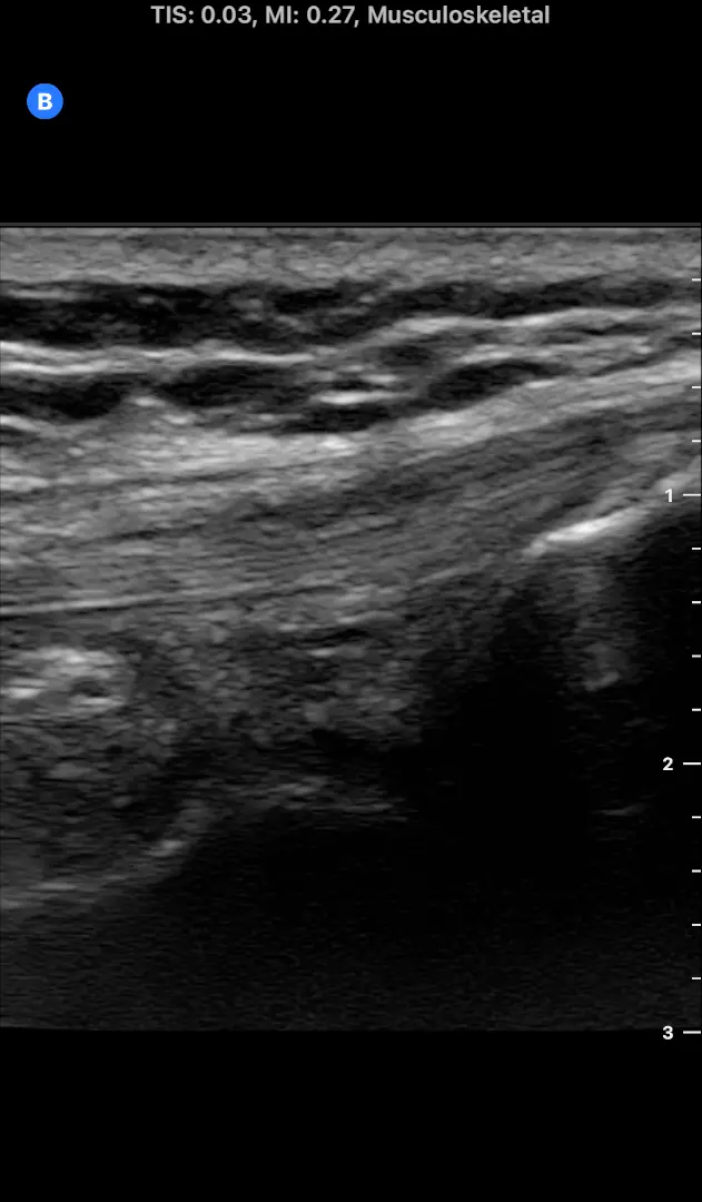 Interested in POCUS clinical images for MSK?