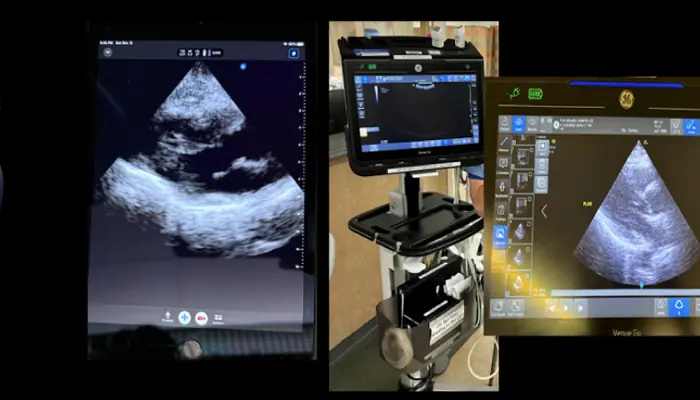 Access POCUS thought leadership in one place.