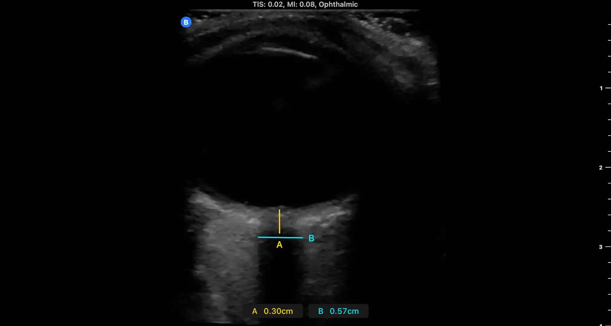 Interested in POCUS clinical images for Primary Care?