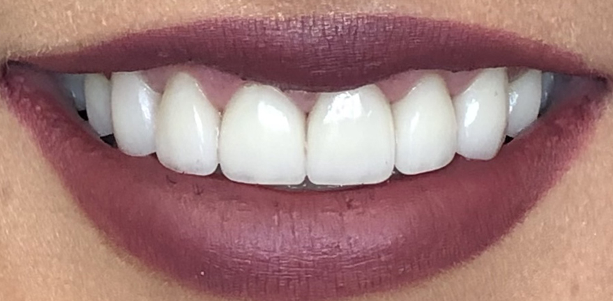 Bowling Green Dentist | Precision Dental