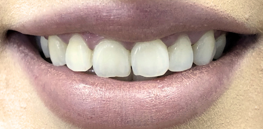 Bowling Green Dentist | Precision Dental