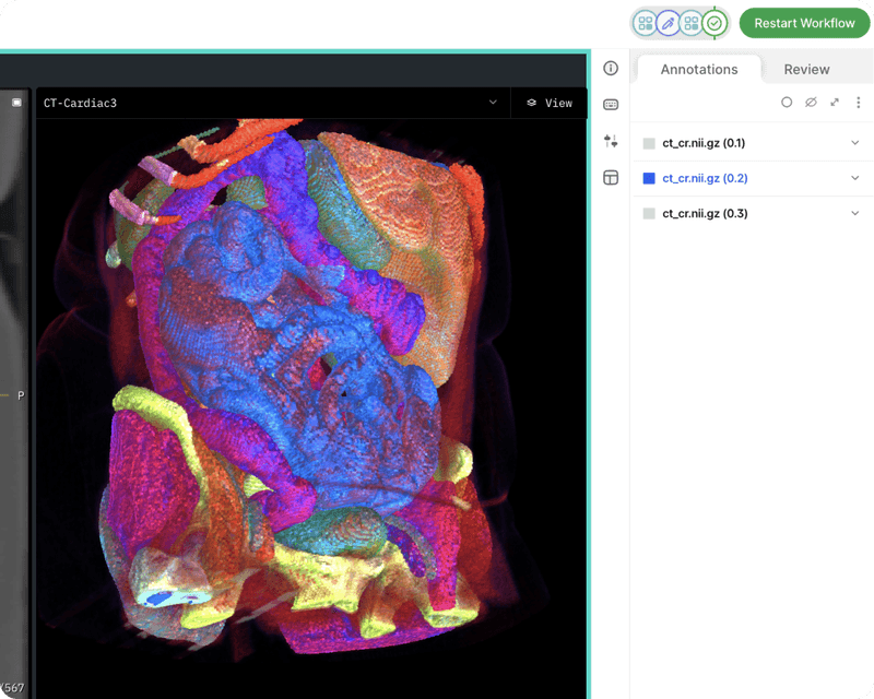 V7 Darwin | AI Data Labeling & ML Training Data Platform