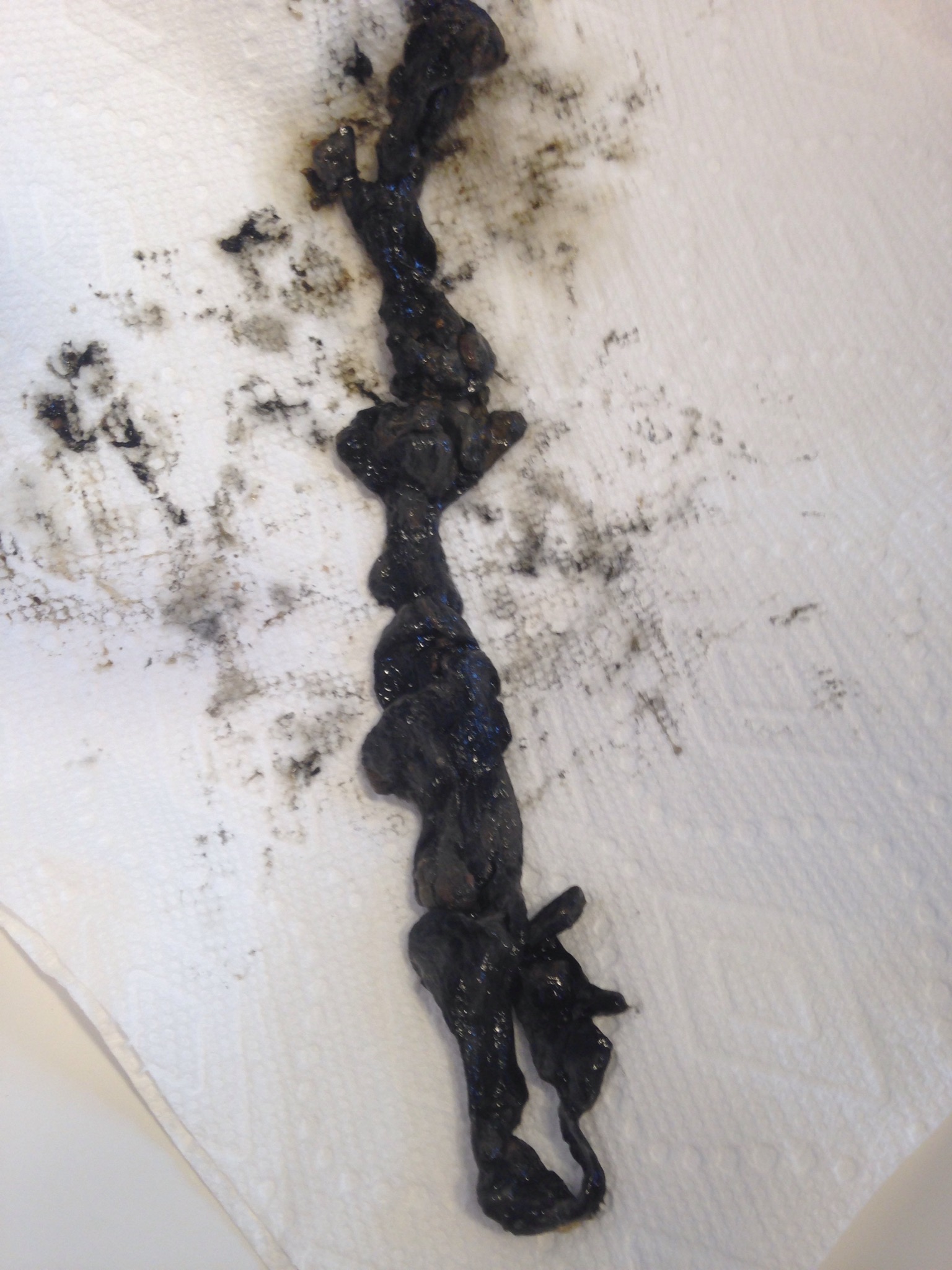 How to Dissolve Mucoid Plaque Naturally | The Detox Dudes Blog