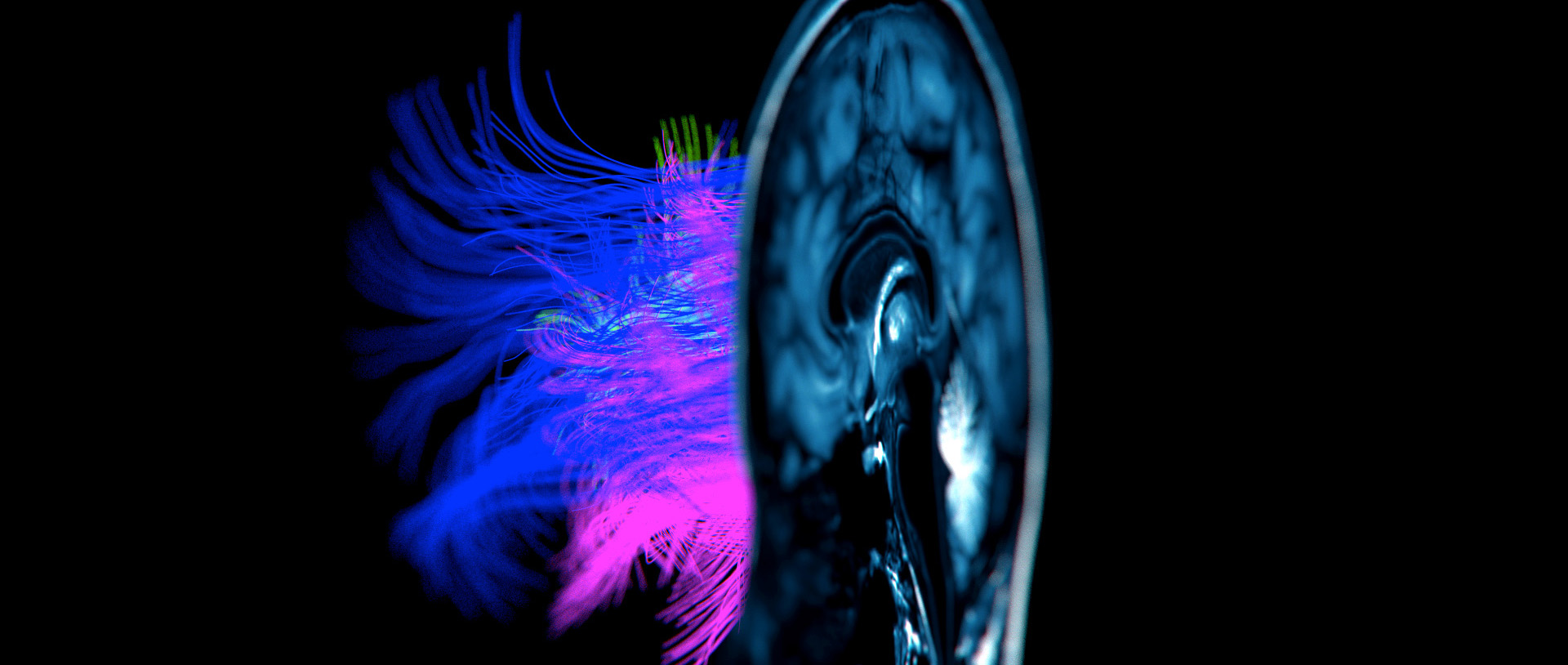 Netflix - Unnatural Selection - Title Design