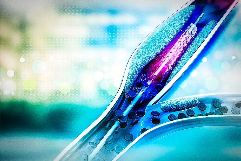 Top Rated Vascular Doctor in New Jersey - Pulse Vascular