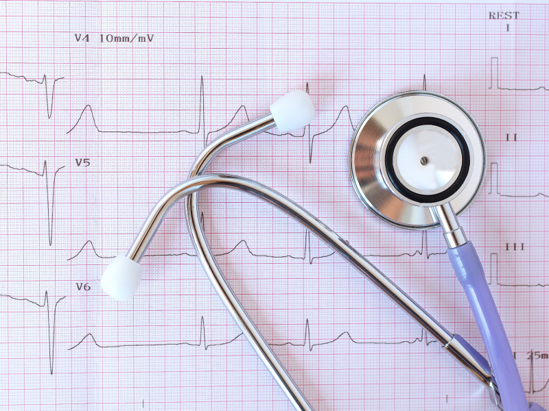 Emergency care: Pre-hospital thrombolysis for STEMI