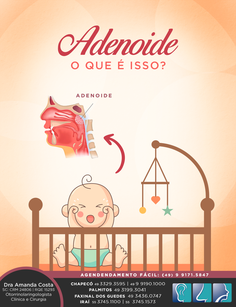 Adenoidectomia | Clínica Costa e Alba