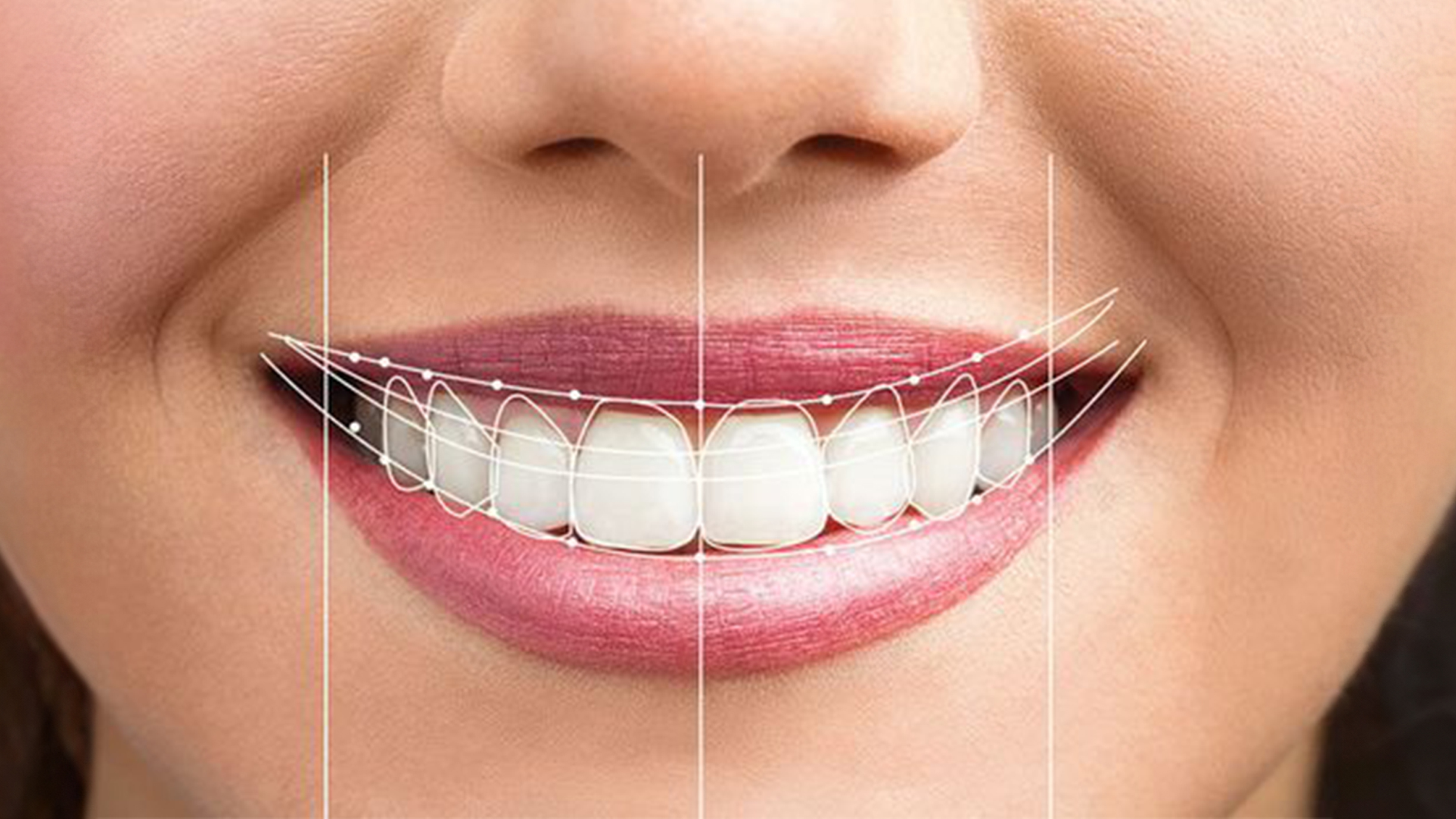Smile Makeover: The Art of Cosmetic Dentistry