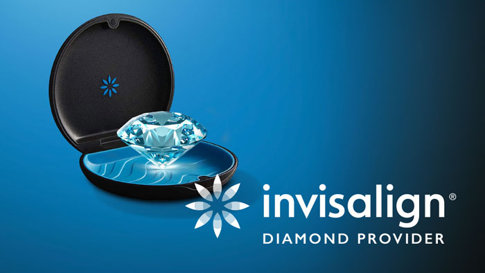 Becoming an Invisalign Diamond Provider: What Does It Mean to Receive ...