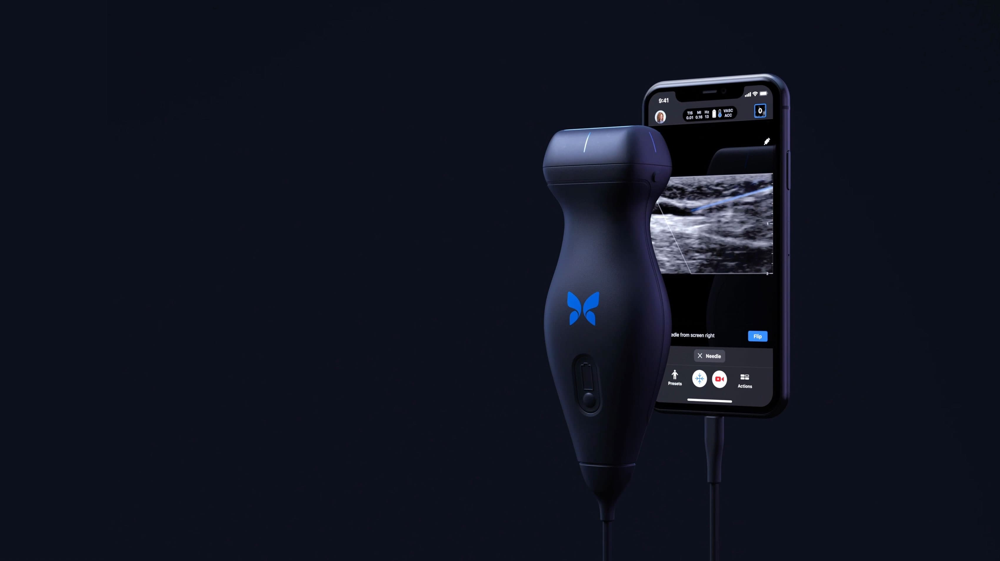 One probe, whole-body imaging | Butterfly iQ+