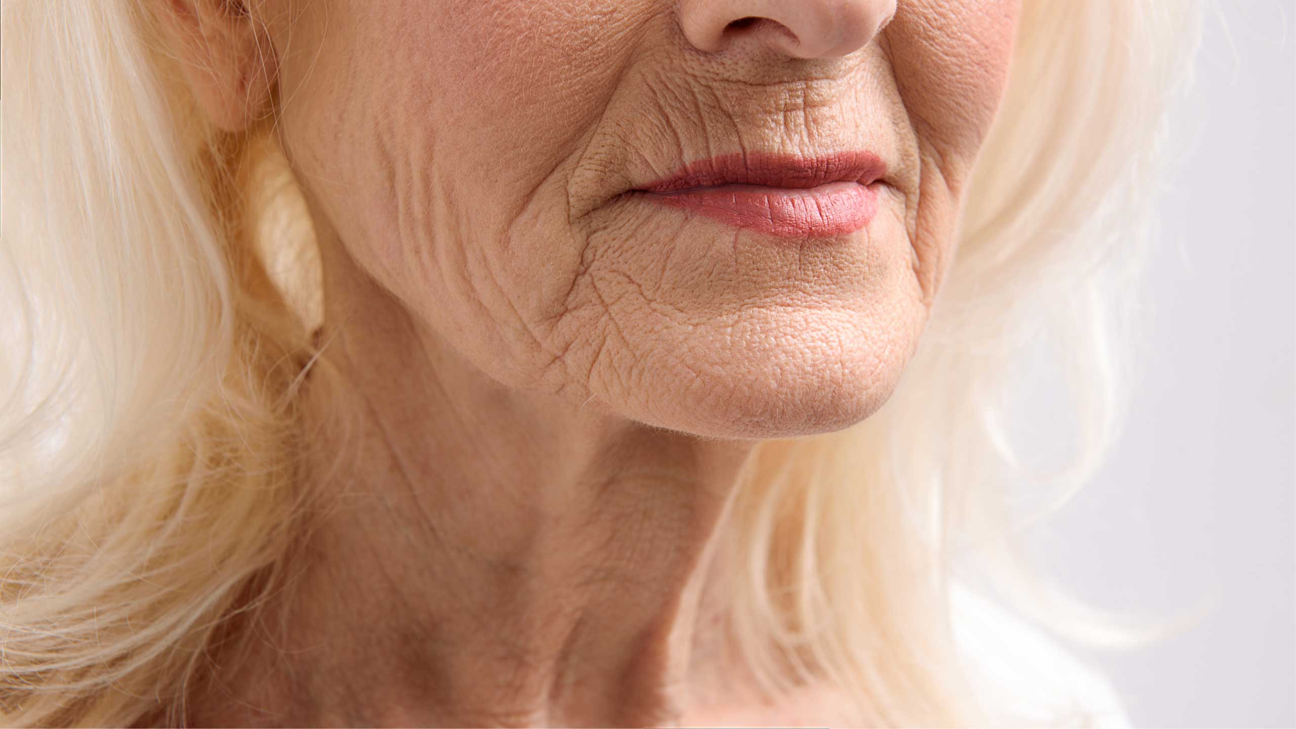 What causes Neck Lines and what treatments are there?