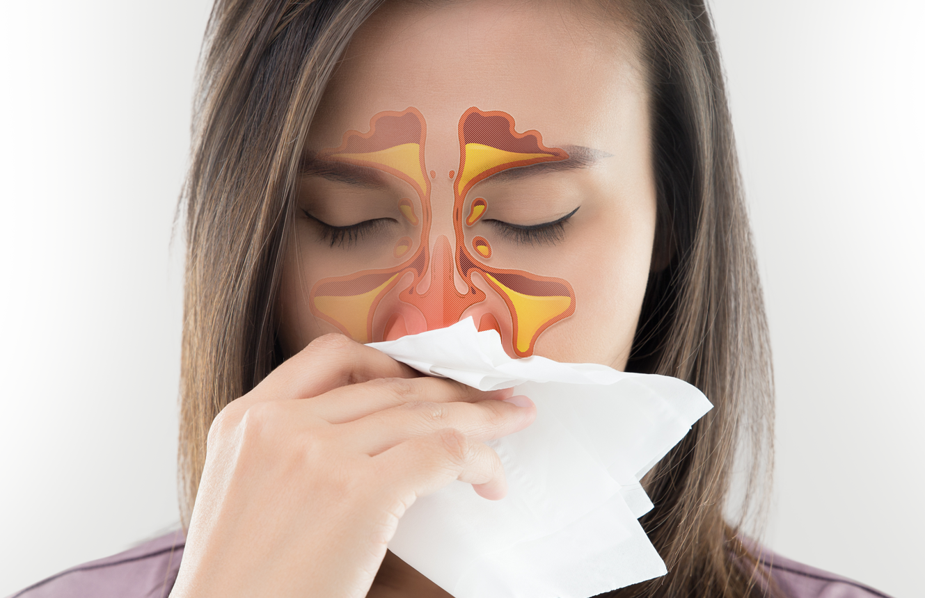 Fast & Effective Care for Chronic Sinus Infections | Walk-ins Welcome